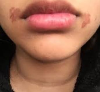 How to choose if Sugaring or waxing is the best hair removal method for ...